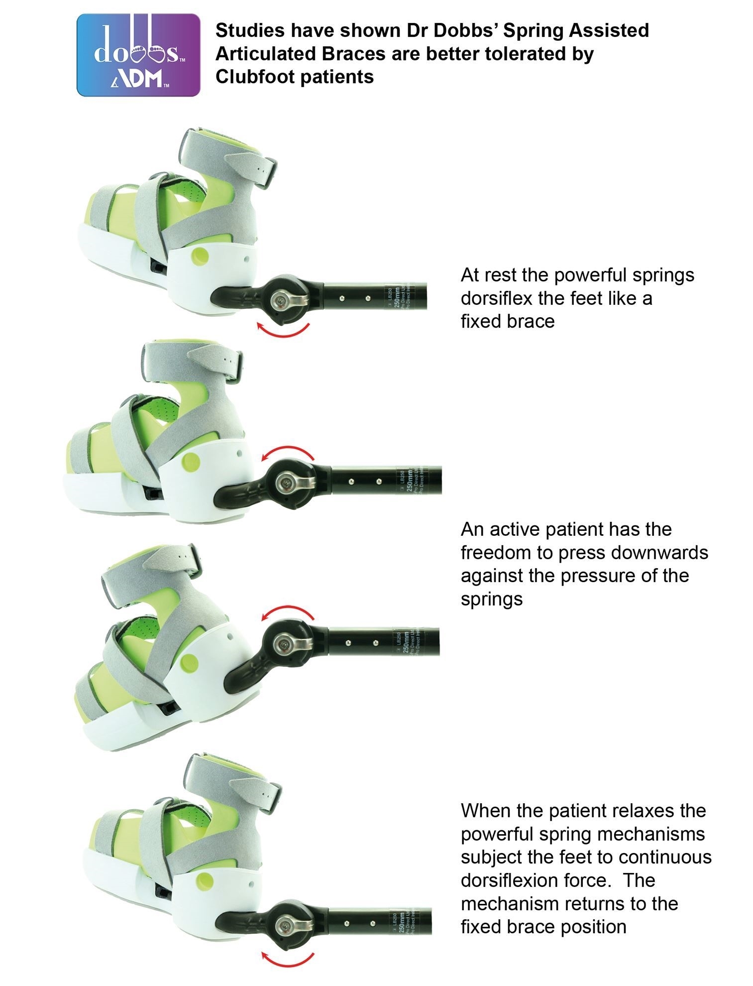 C-Pro Direct. Pair of ADM Night Use AFOs and Spring Assist Articulating ...